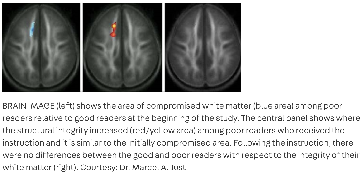 Unlocking Neuroscience: Effective Reading Strategies & Benefits